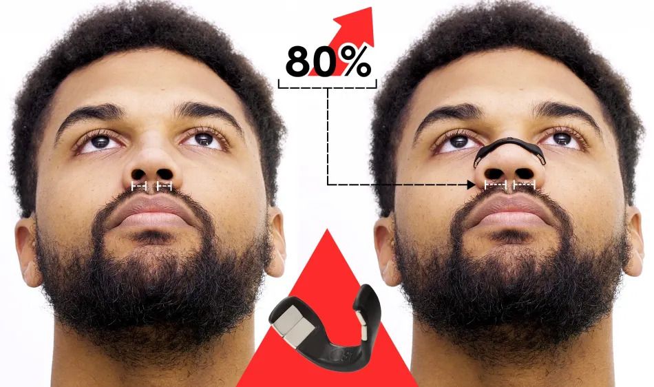 Intake Breathing Dilator Review: Does it Open Passages?